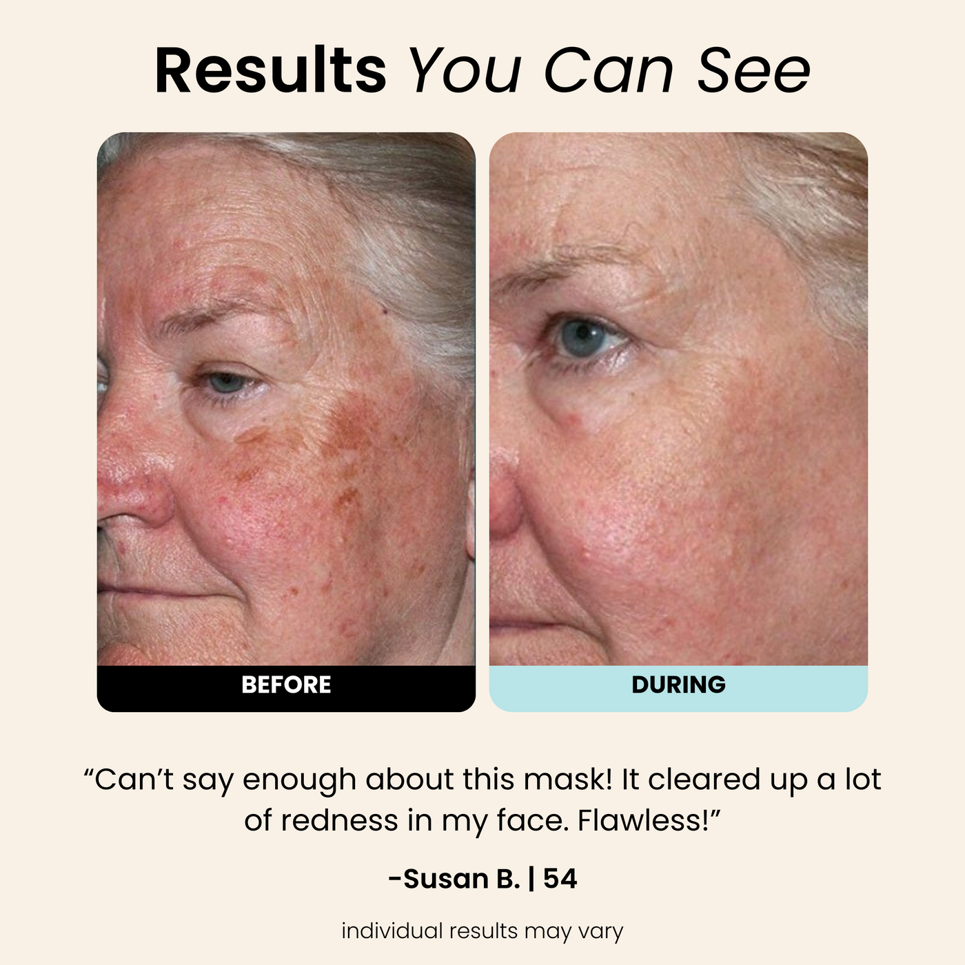 Wrinkle Clearing Light Therapy Face & Neck Mask – Nutriskin