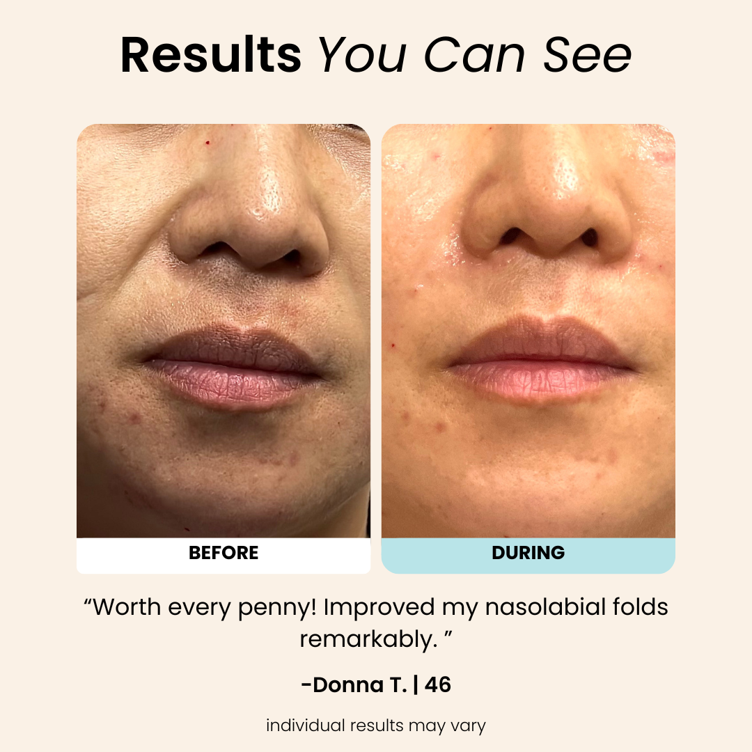 Silicone Wrinkle & Acne Clearing Light Therapy Face, Neck & DÉCOLLETÉ ...